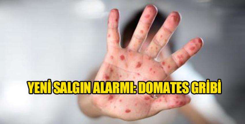 Domates gribi hakkında merak edilenler